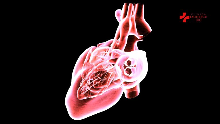 RMN Cardiac - Diagnostic Avansat pentru Afectiunile Inimii | Eminescu 100