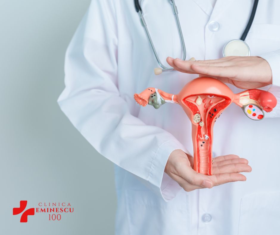 Endometrioza - Simptome si Tratament - Clinica Eminescu 100