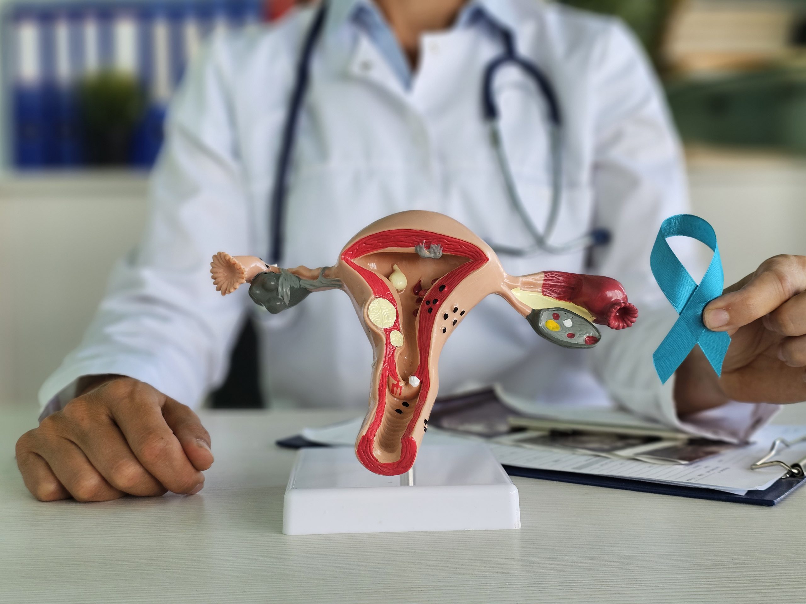 Preventia cancerului de col uterin (cancer cervical), Cauze, Simptome ...