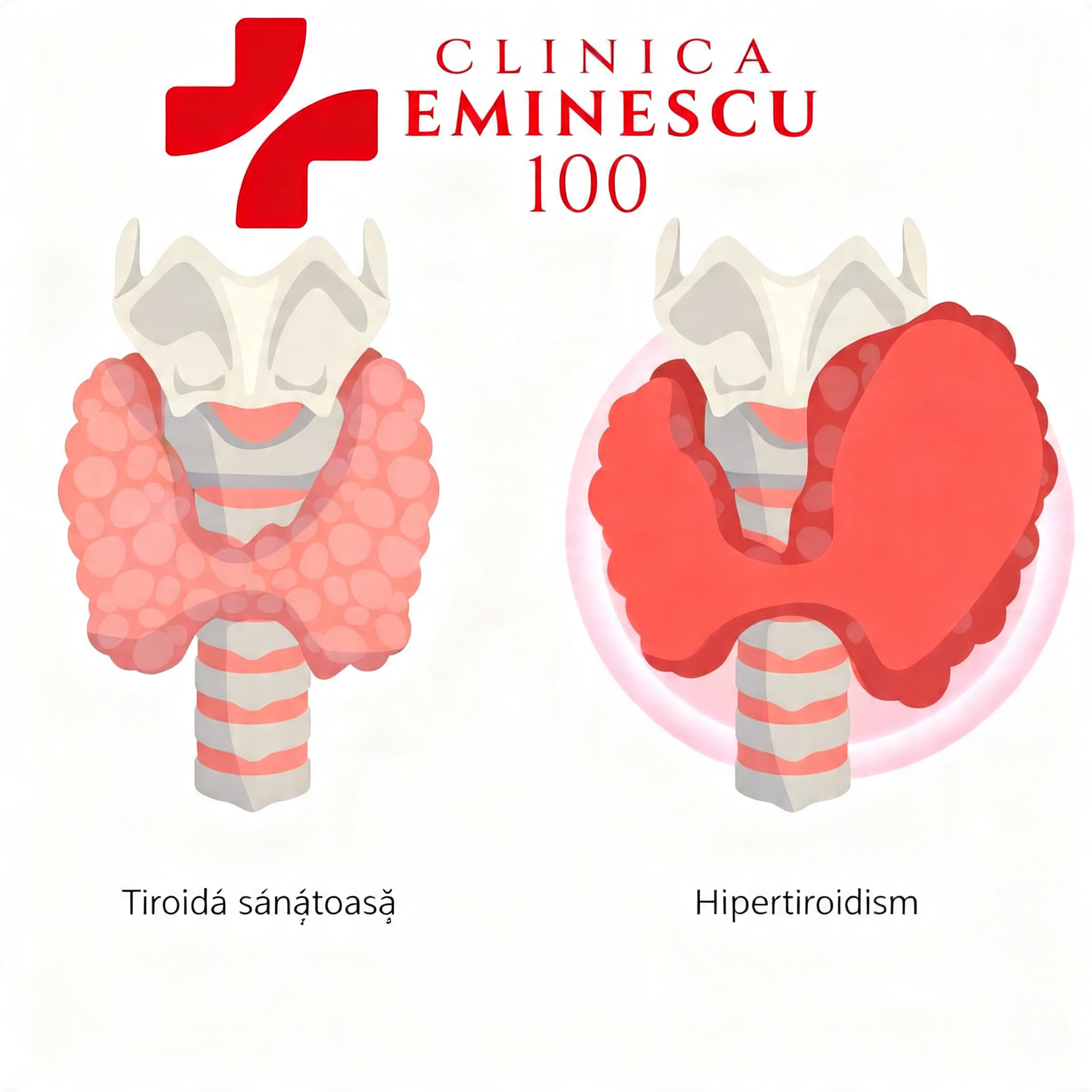 Tiroida – simptome, functionare si analize | Clinica Eminescu 100